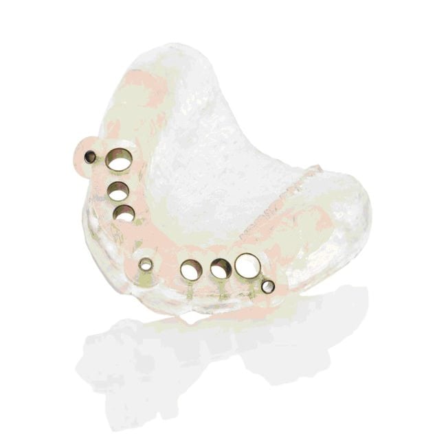 SimPlant - Perio Center